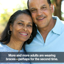 The 5 Most Common Types of Braces - Orthodontics Limited