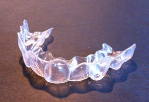 A Complete History of Invisalign